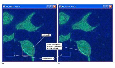 Microscopy: Fluorescent Resonance Energy Transfer (FRET) Bleed Through ...